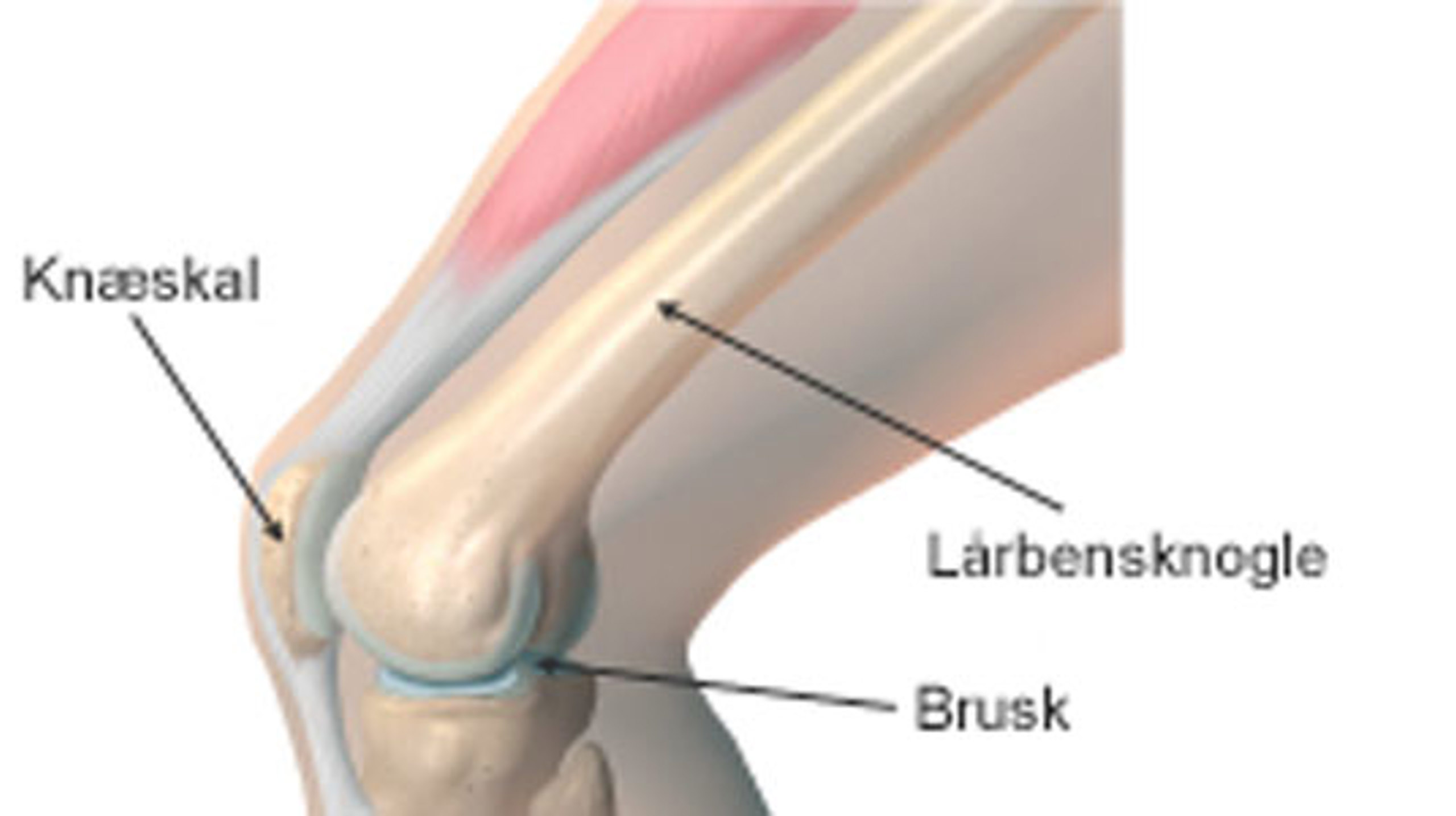 Skade på menisk i knæet | Hurtig afklaring og behandling